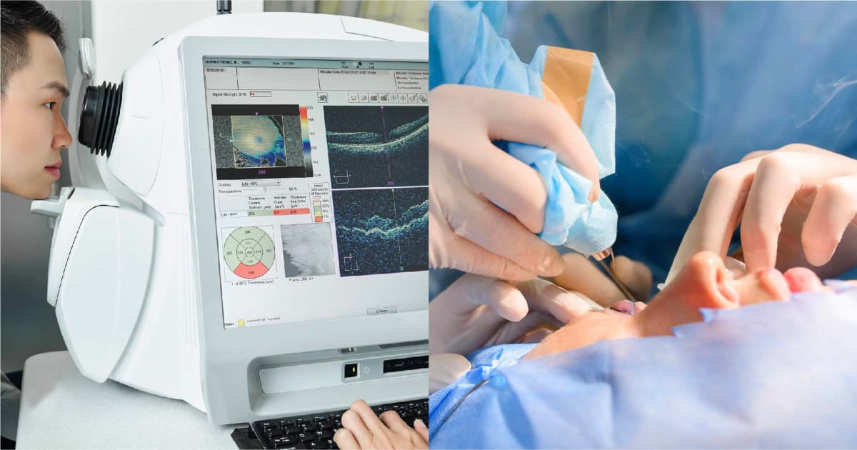 The Ultimate Guide To Ptosis In Singapore 2021